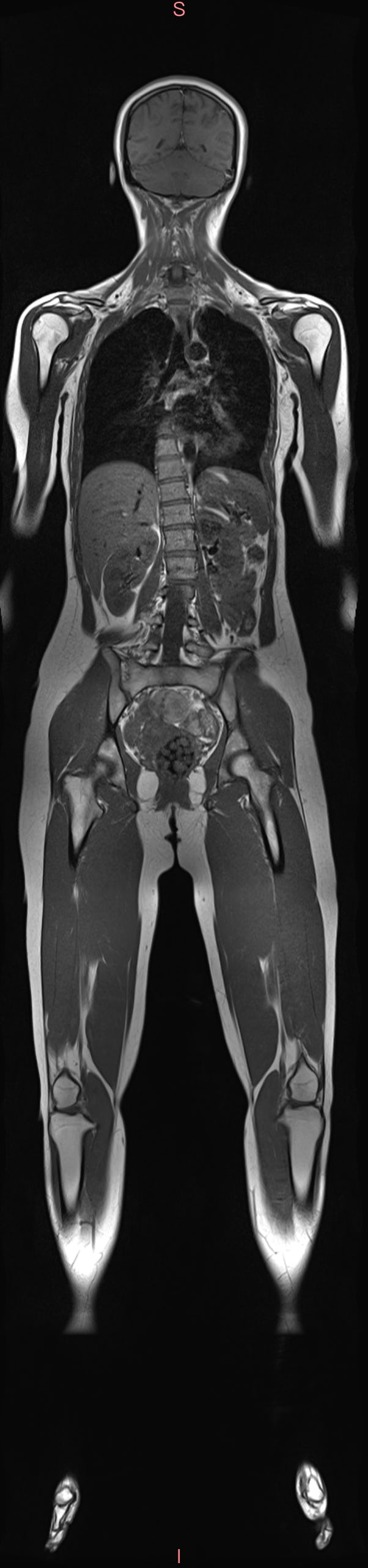 Prenuvo Review: Is The Kim Kardashian-Endorsed Body Scan Worth The Cost?