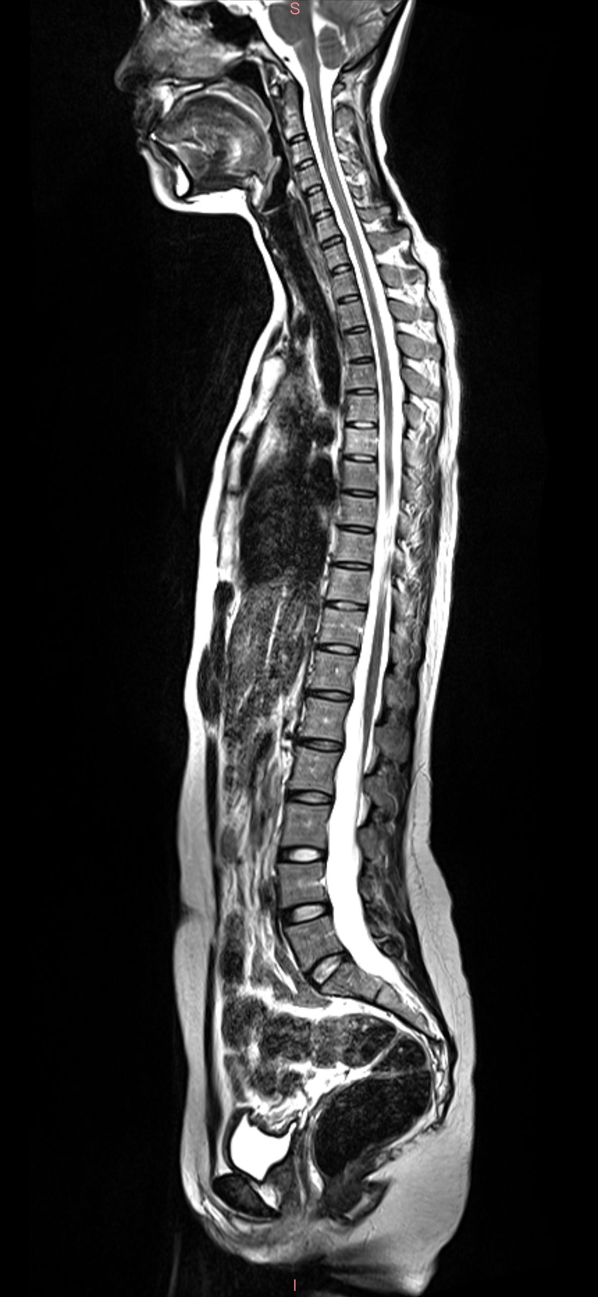 Prenuvo Review: Is The Kim Kardashian-Endorsed Body Scan Worth The Cost?