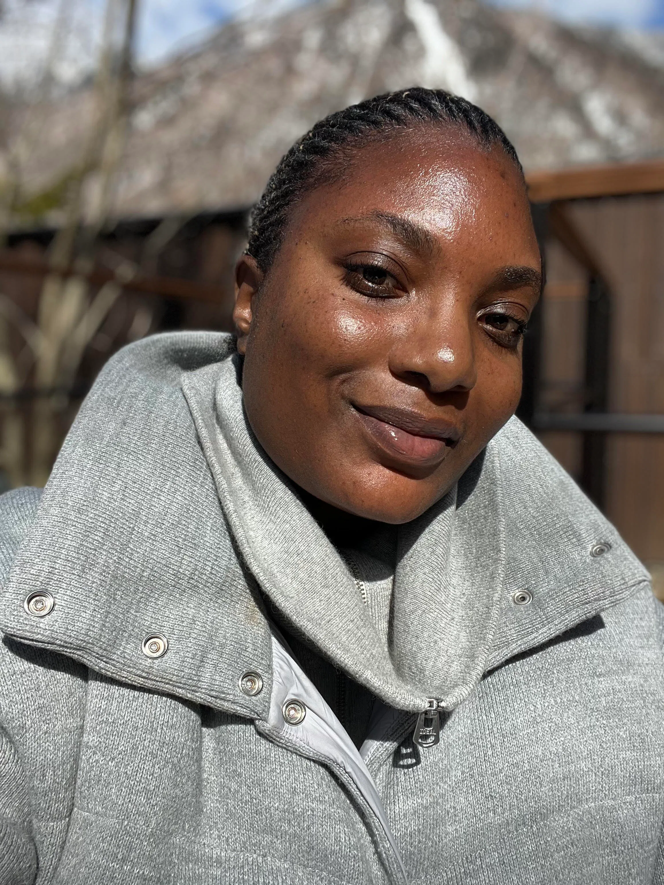 Can Exosomes Improve Hyperpigmentation In Dark Skin Tones?