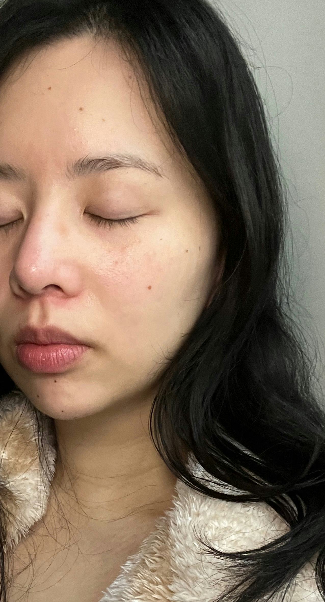 Ilso Natural Mild Clear Nose Patch: The Viral K-Beauty Mask For Blackheads