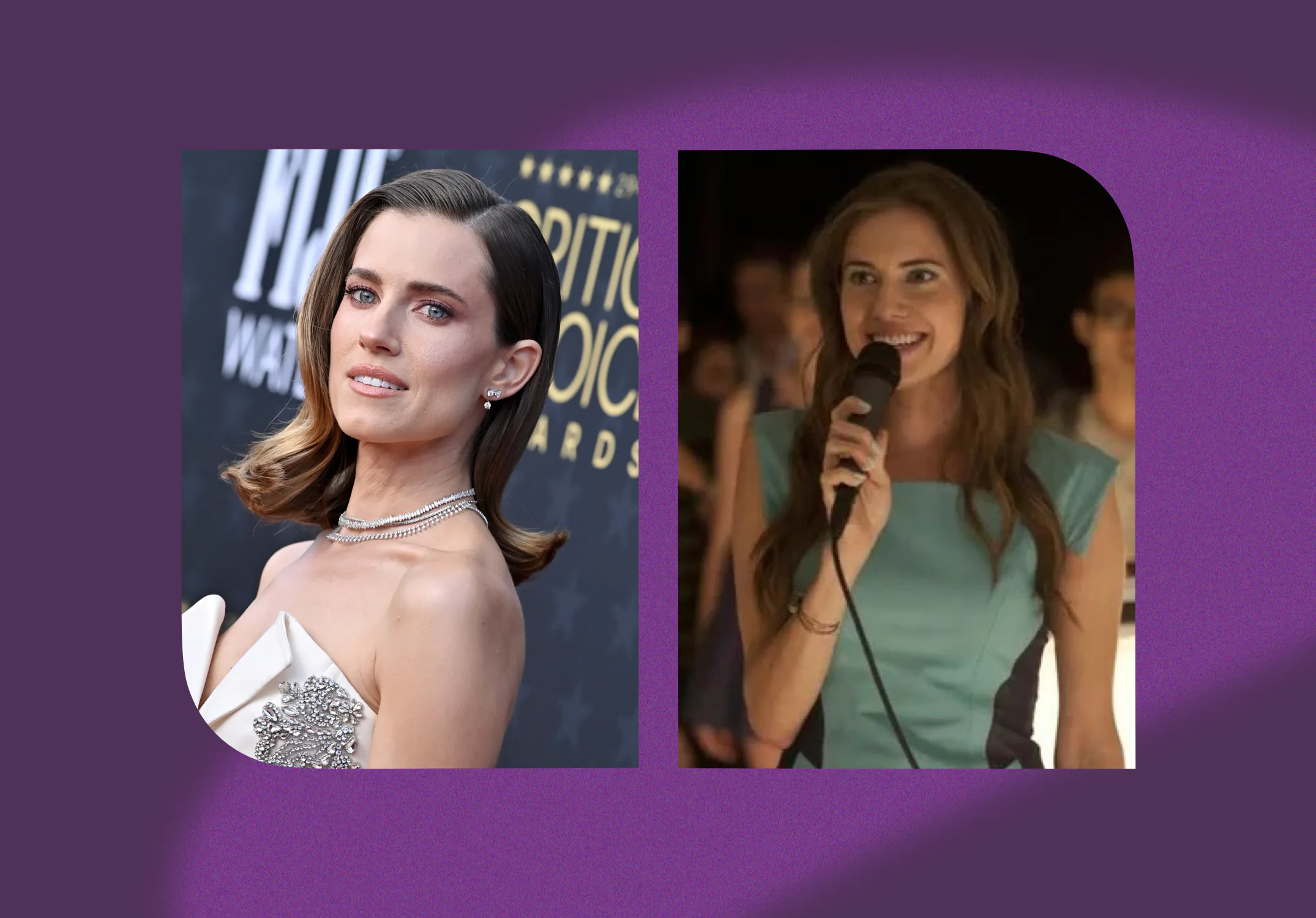Allison Williams Plastica No Nariz Antes E Depois