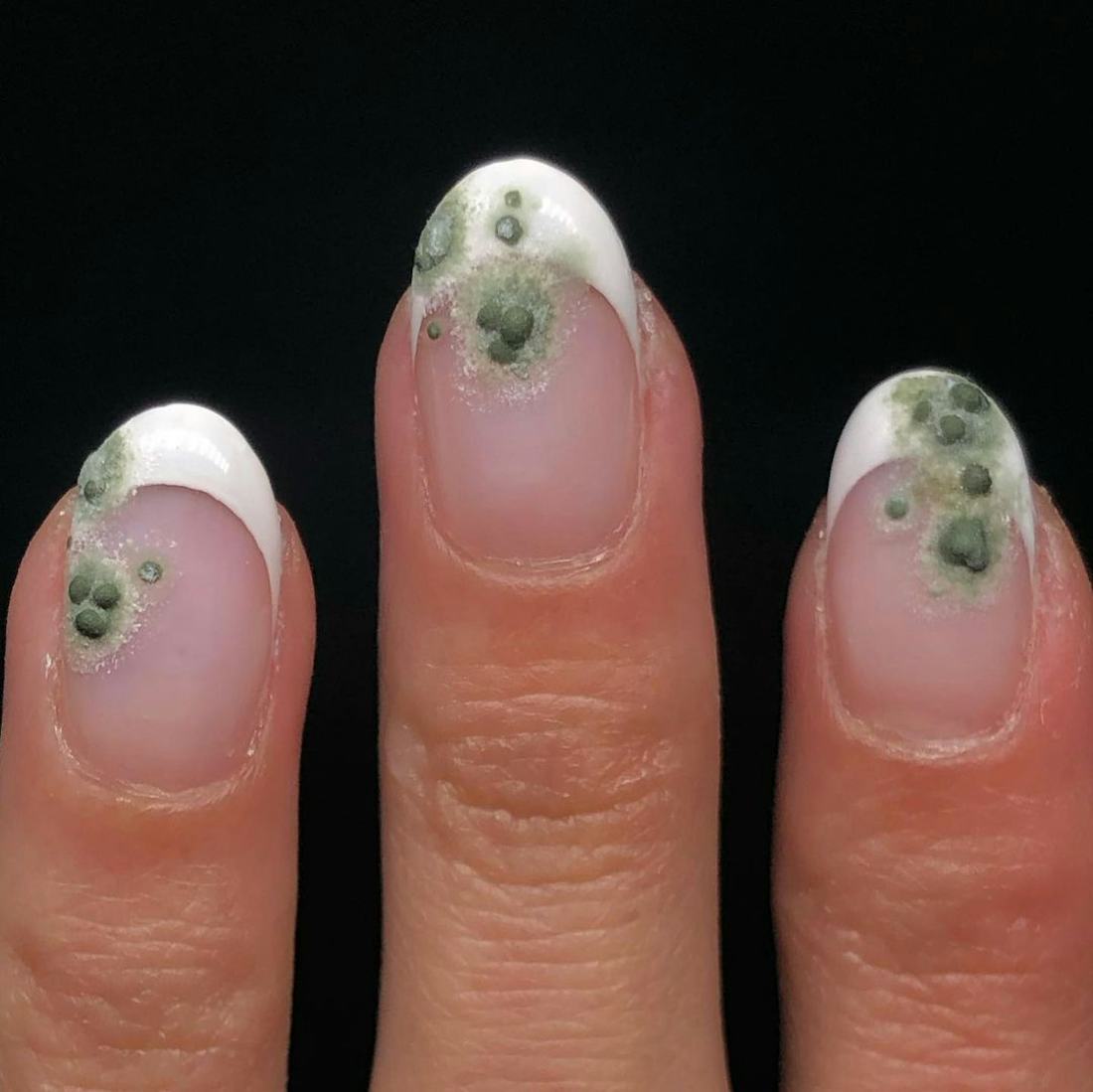Hyper-Realistic Nail Art Is Trending & It’s Utterly Disgusting