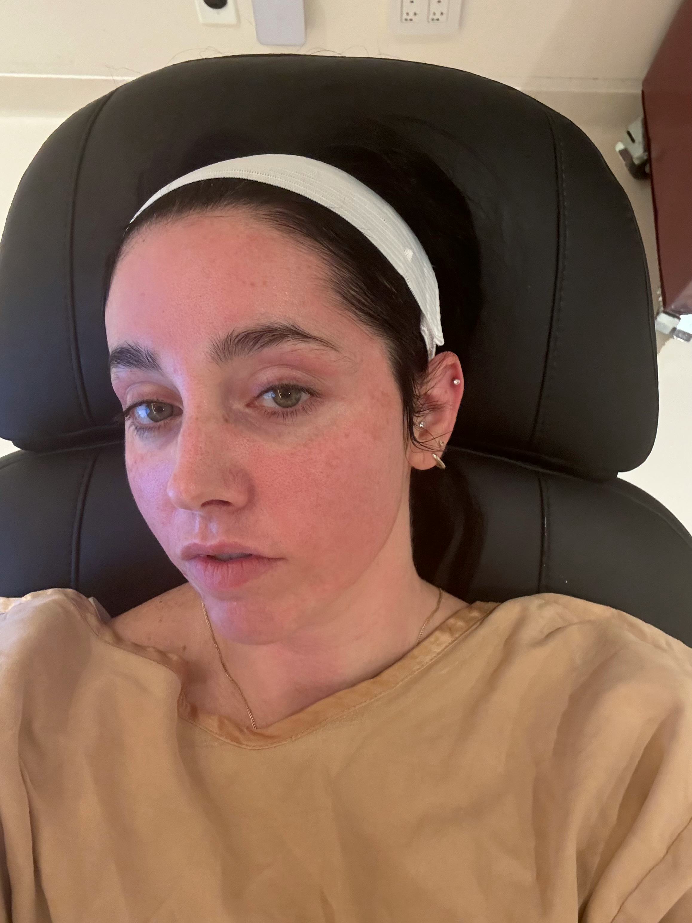 Miria Laser Review: Benefits & Results Of The New Treatment