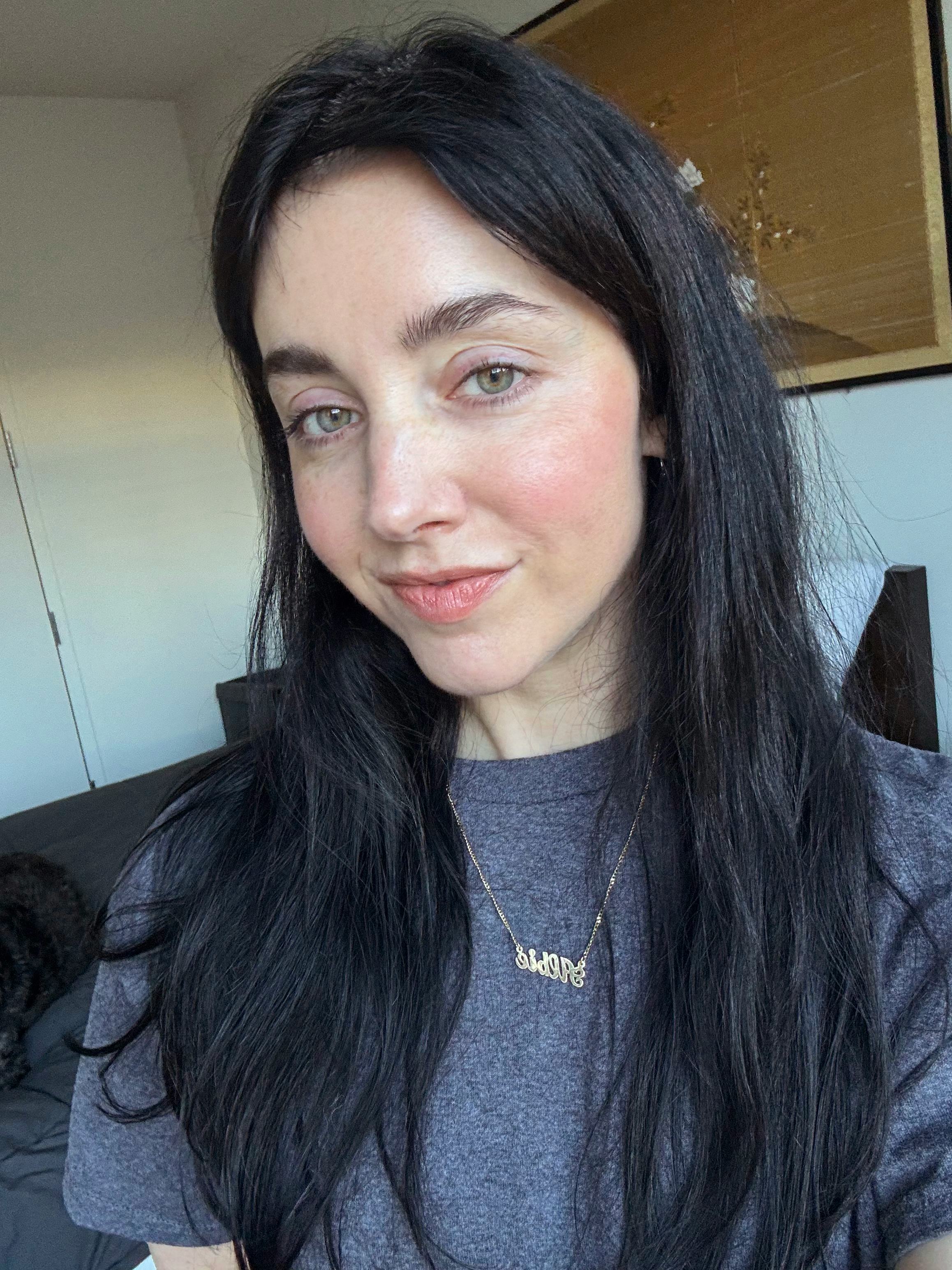 Miria Laser Review: Benefits & Results Of The New Treatment