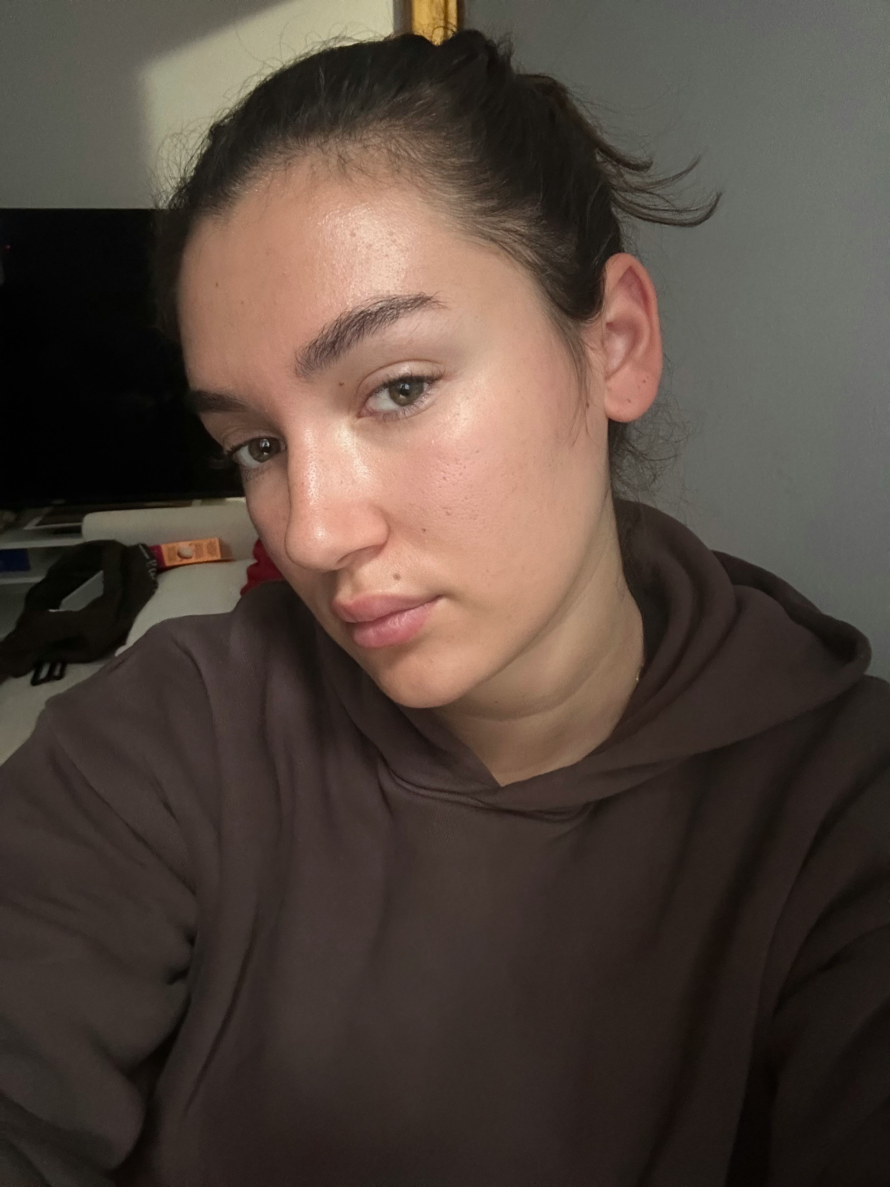 Rhode's Peptide Depuffing Eye Patches Made Me Look More Awake