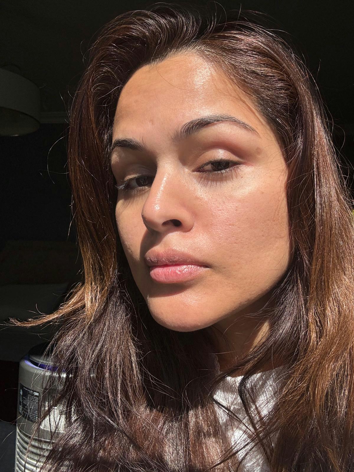 I Got A Botox Facial For Glass Skin – Here's What Happened