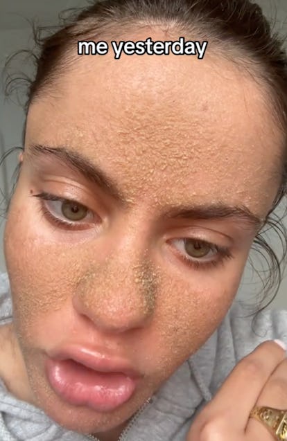 “Caveman Method” Skin Care Is Going Viral On TikTok