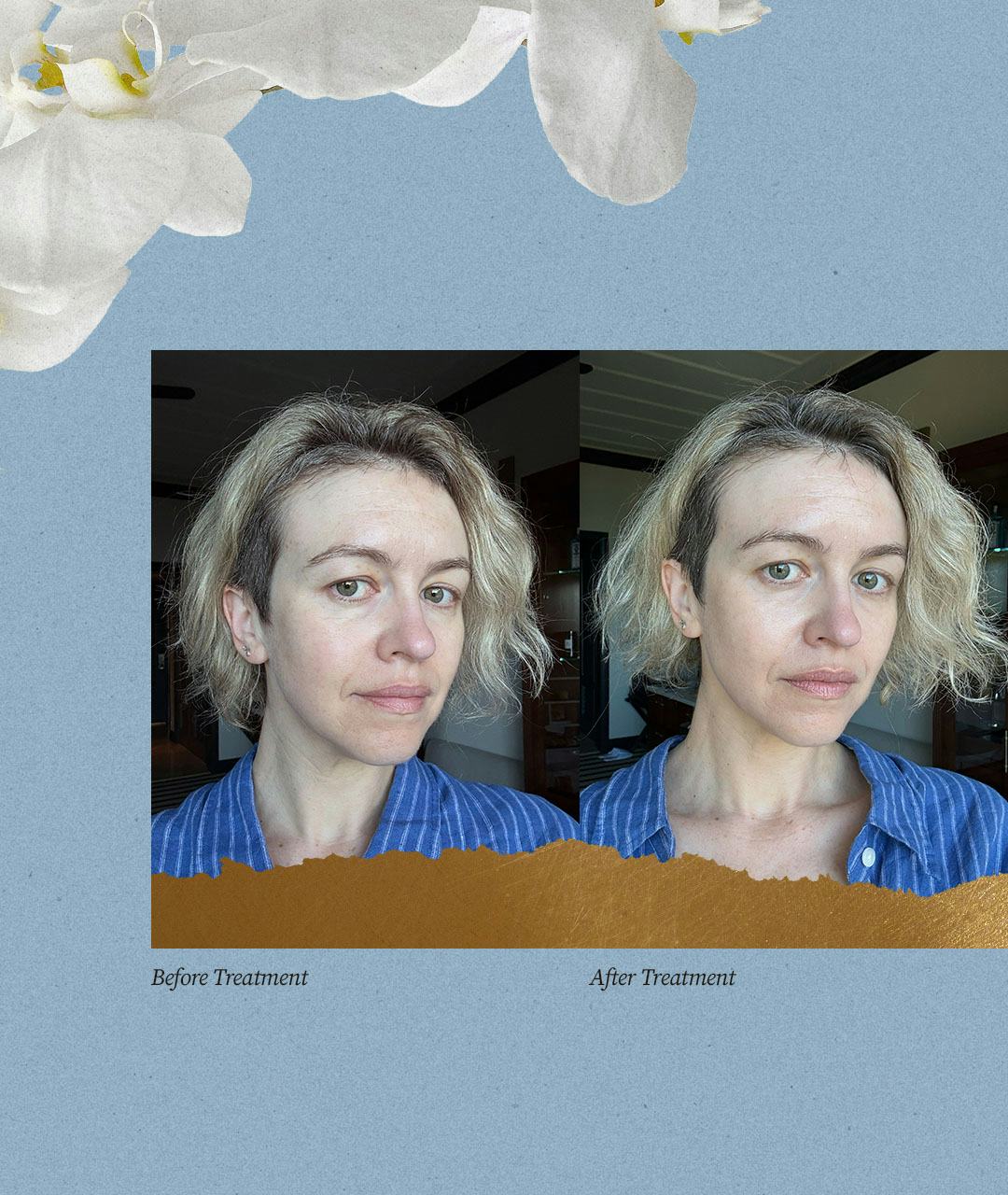 111Skin's Exosome Regeneration Facial Is Worth The Flight To The Cayman ...