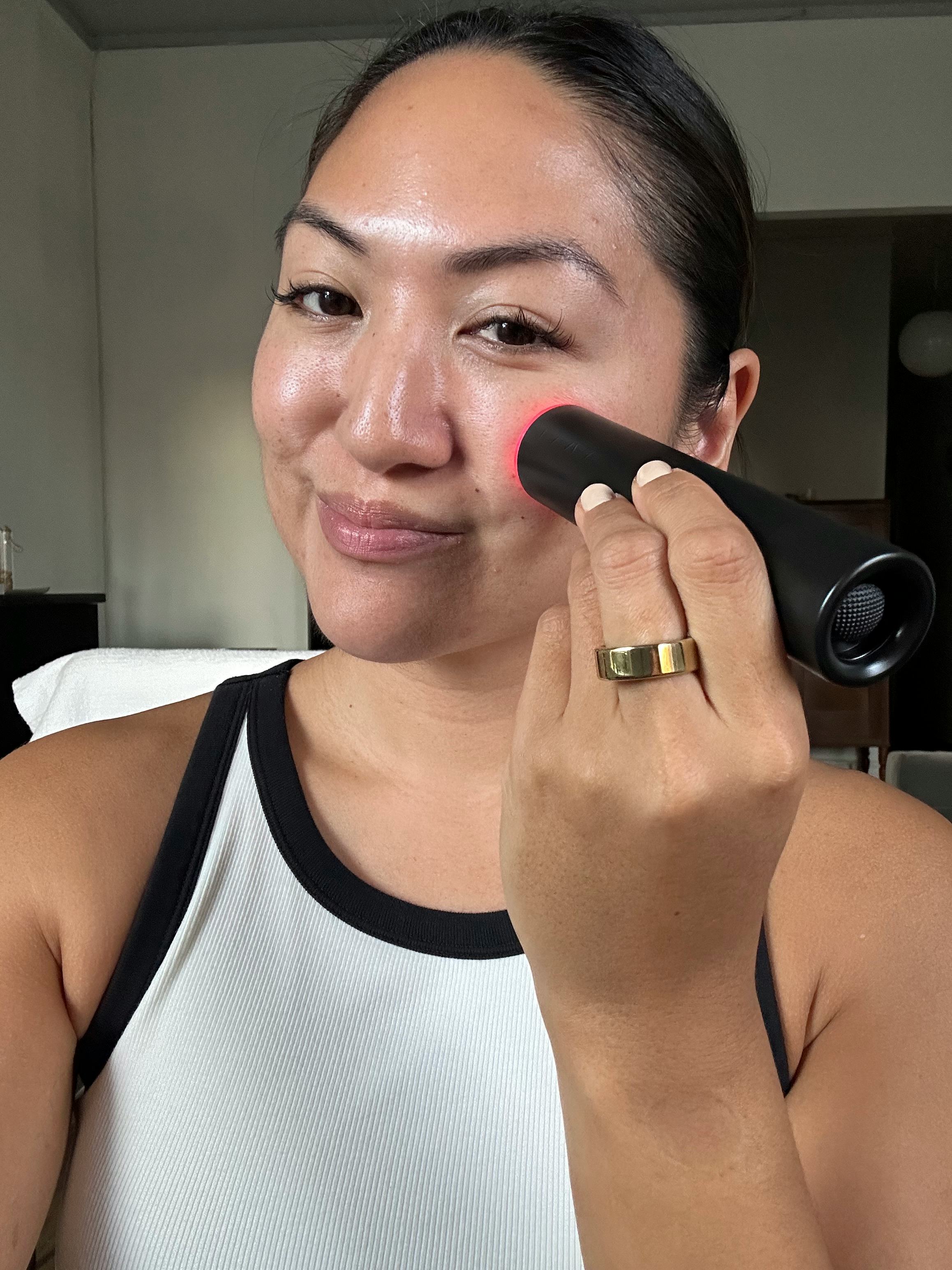 The Cost Of Getting Rid Of Acne Is More Than Financial