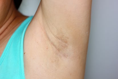 Botox Injections For Your Armpits Can Help Curb Sweating. Here's What ...