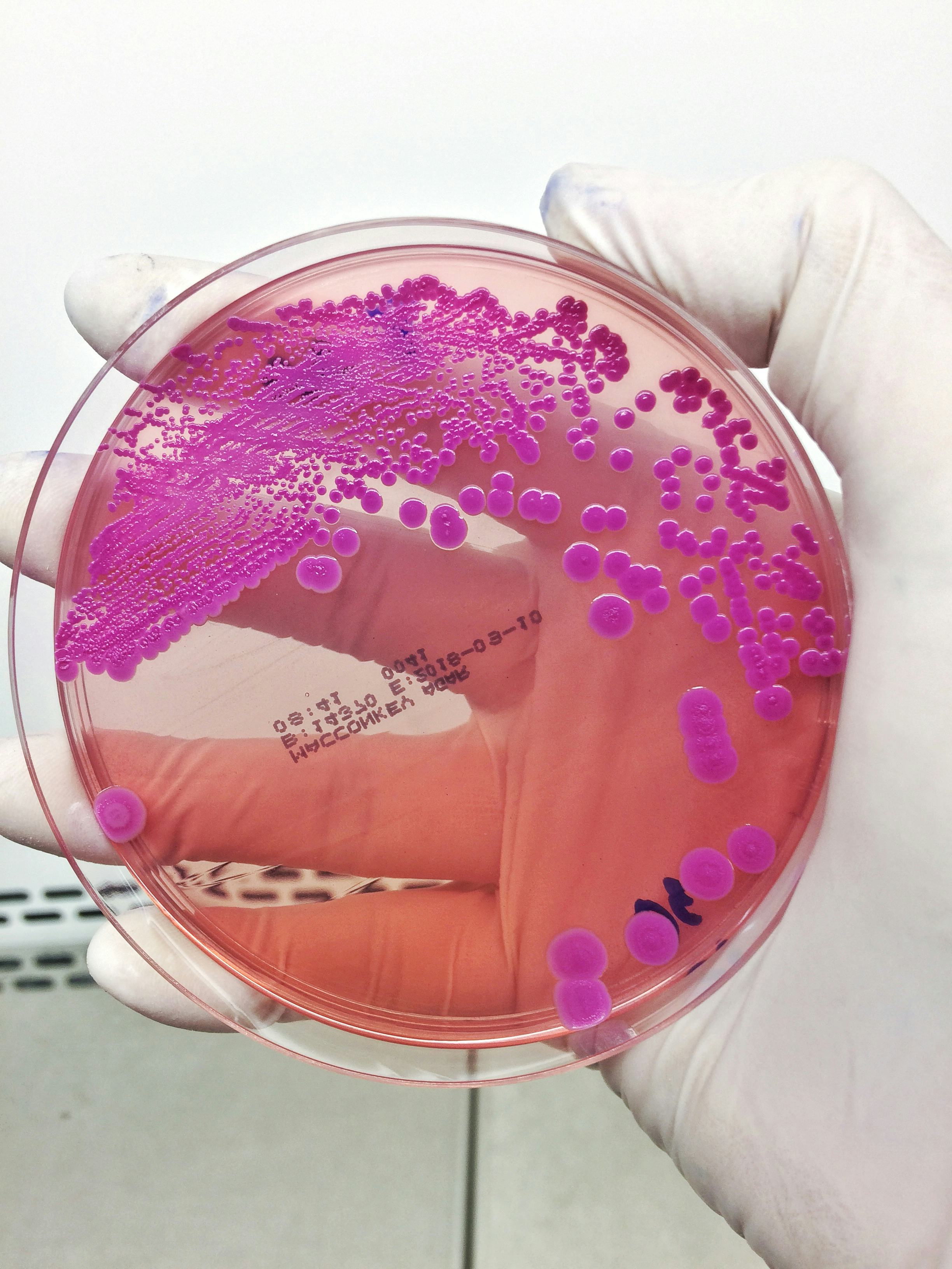 Look: Beetles stash an important family heirloom in a little pocket